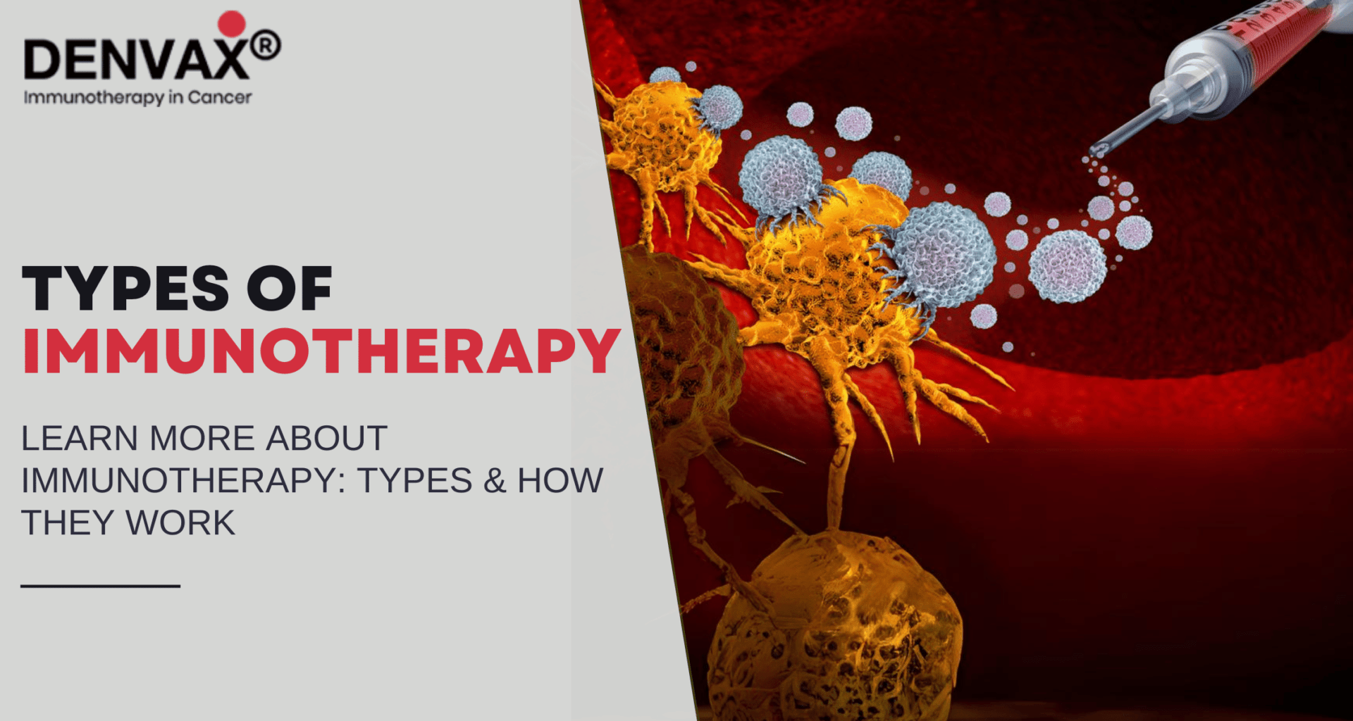 Types Of Chemotherapy