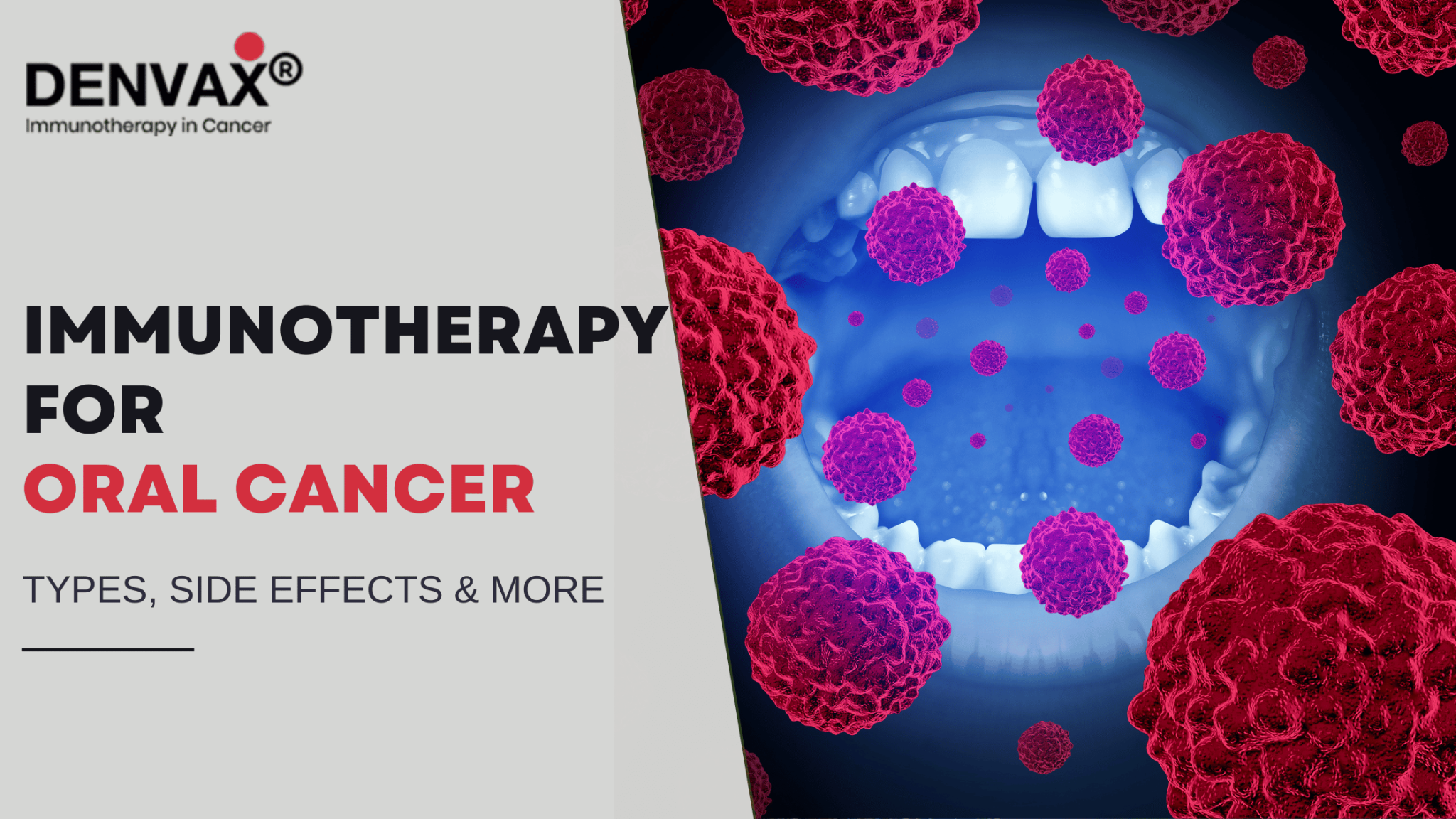 Immunotherapy for Oral Cancer: Types, Side Effects & More - Denvax