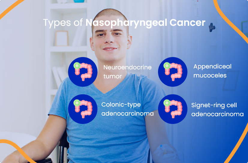 Appendix Cancer: Causes, Symptoms, Types & Diagnosis