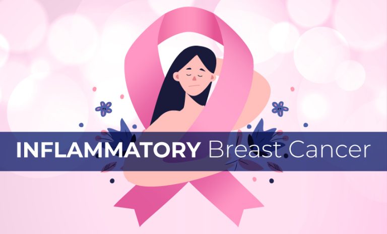 Inflammatory Breast Rash vs. Infection | Denvax