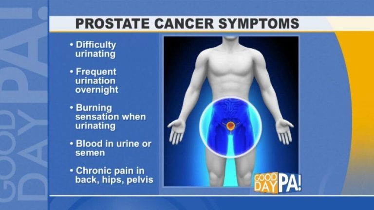 Gleason Score in Prostate Cancer:: Stages & Treatment Guide